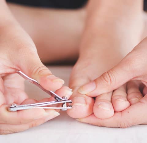 Ingrown Toenails | Irving Foot & Ankle